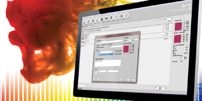 Soluzioni di gestione del colore X-Rite